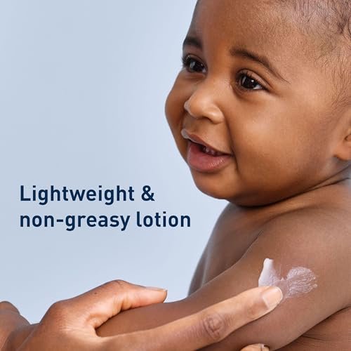 Best Baby Lotion For Eczema Prone Skin: Top Gentle Picks - BestGearReviews